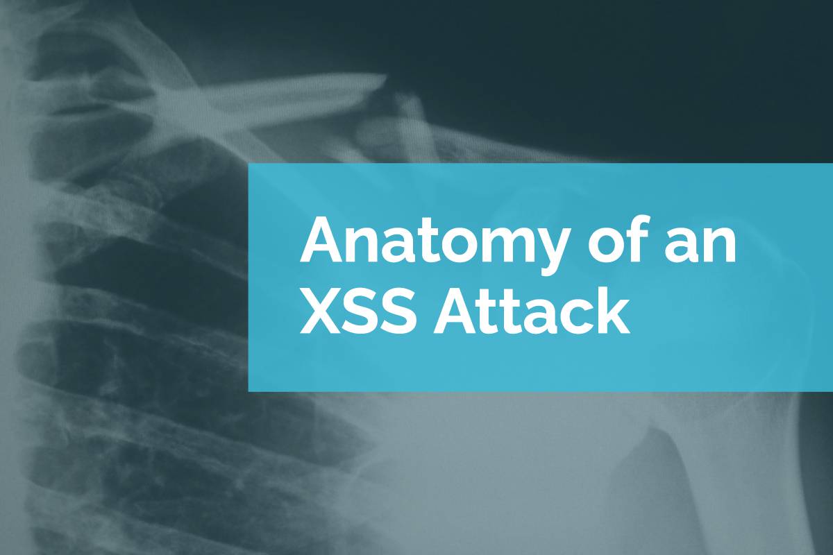 Anatomy of an XSS Attack - Pixel Jar